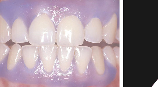 Wolf Zahntechnik Patienteninformation