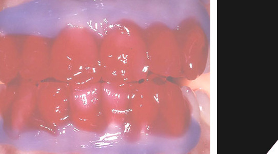 Wolf Zahntechnik Patienteninformation