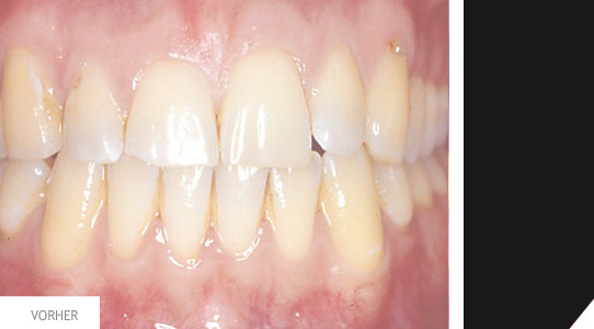 Wolf Zahntechnik Patienteninformation