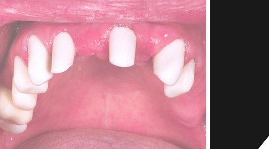 Wolf Zahntechnik Patienteninformation