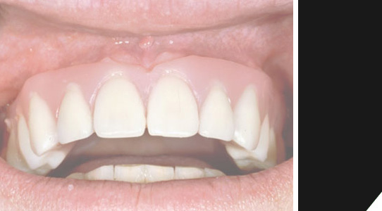 Wolf Zahntechnik Patienteninformation