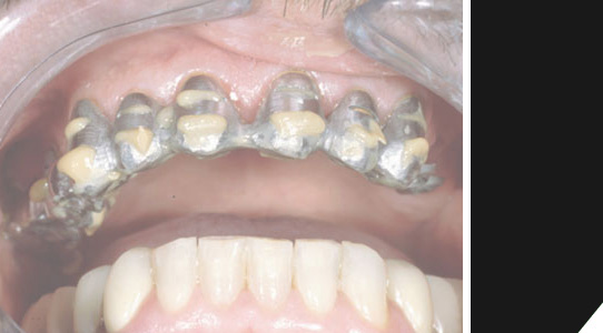 Wolf Zahntechnik Patienteninformation