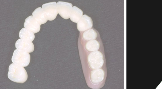 Wolf Zahntechnik Patienteninformation