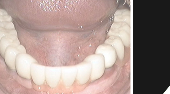 Wolf Zahntechnik Patienteninformation