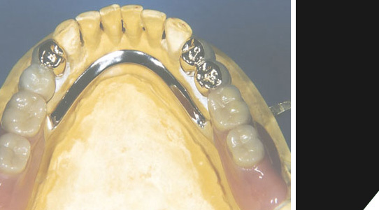 Wolf Zahntechnik Patienteninformation