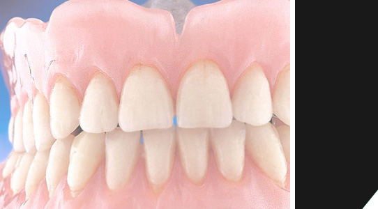 Wolf Zahntechnik Patienteninformation