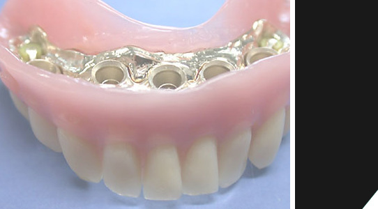 Wolf Zahntechnik Patienteninformation